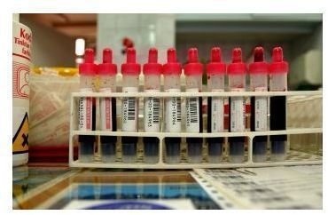 Learn What Test Are Included In The CMP Blood Test Bright Hub